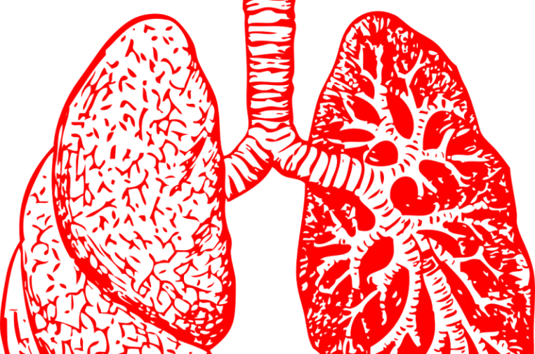 Neumotórax | Qué es, síntomas, tratamiento | Espontaneo, por tensión