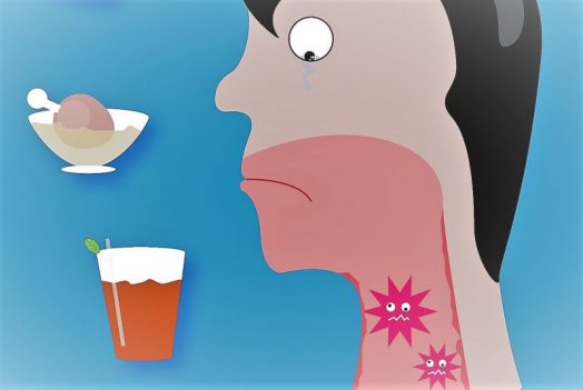 Angina de garganta | Qué es, síntomas, tratamiento, causas | Amigdalitis