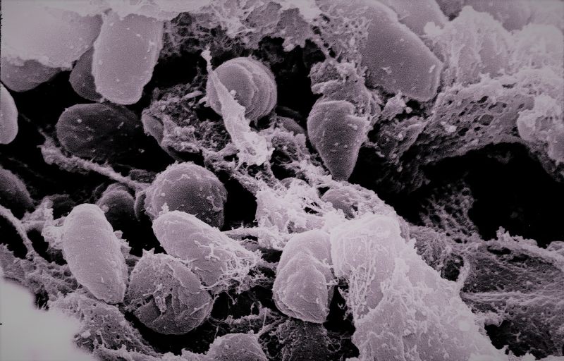 Peste bubónica | Qué es, síntomas, diagnóstico, tratamiento, contagio