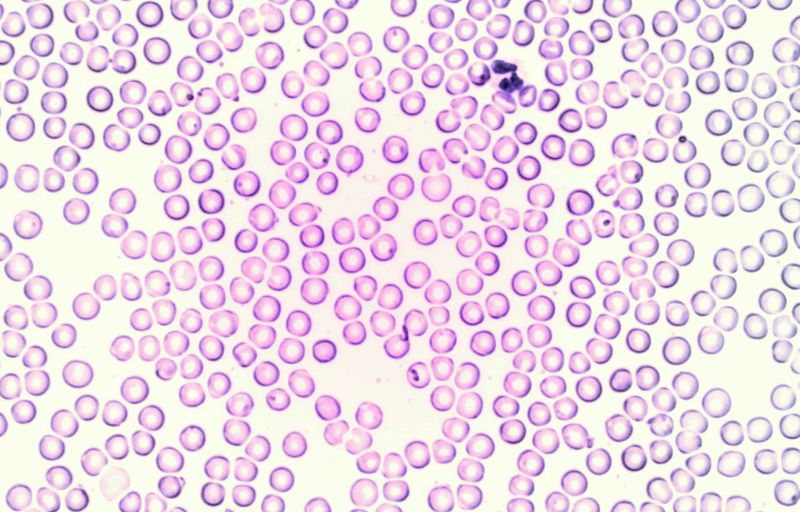 Eosinófilos | Qué es, definición, función, estructura, formación, altos ...