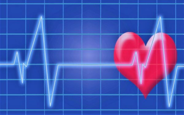 Taquicardia sinusal | Qué es, causas, tratamiento, síntomas, diagnóstico