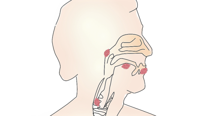 Epiglotis | Qué es, caracterísitcas, función, enfermedades | Epiglotitis